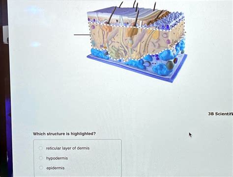 Solved Which Structure Is Highlighted Reticular Layer Of Dermis Hypodermis Epidermis 3b