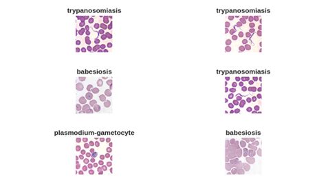 Parasite Classification Using Wavelet Scattering And Deep Learning