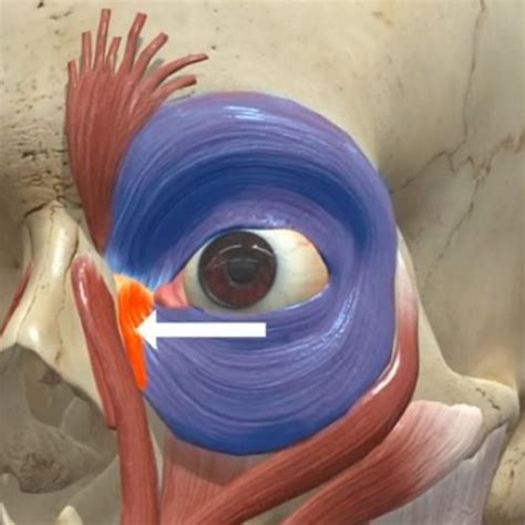 How To Avoid Unwanted Lines From Botox Dr Tim Pearce