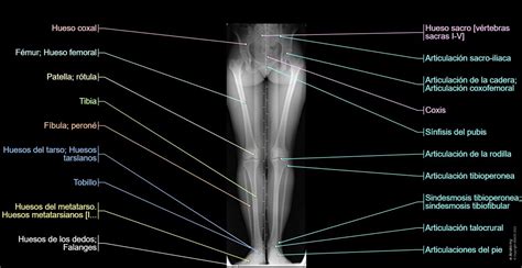 Anatomía De La Radiografía Lateral Del Pie Biomecánica Del Pie Cavo