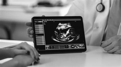 Obstetrics Wallpapers Top Free Obstetrics Backgrounds Wallpaperaccess