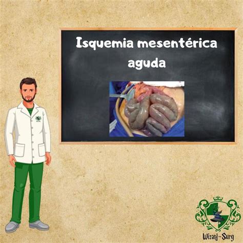 Isquemia Mesentérica Aguda Wizard Med Udocz