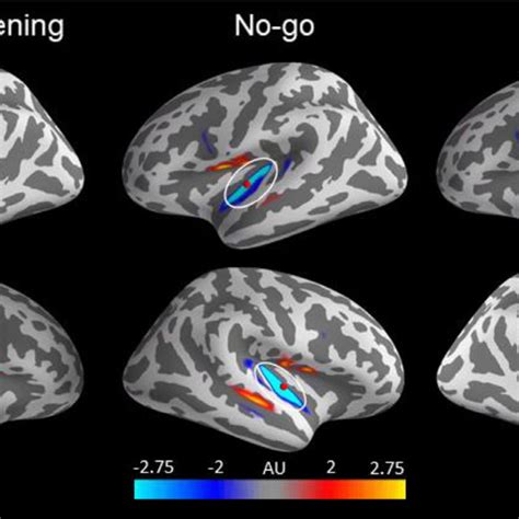 Grand Average 3d Visualization Of The M Eeg Combined Estimates Of The