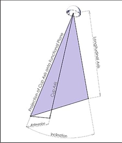 Table 2 From Improving Acetabular Component Positioning In Total Hip Arthroplasty A Cadaveric