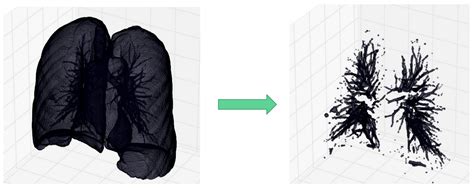 My Experience Participating In Kaggle Data Science Bowl 2017 Lung Cancer Detection By Ashish