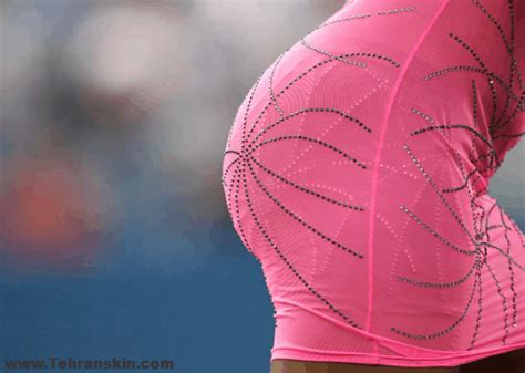 All You Need To Know About Buttock Augmentation