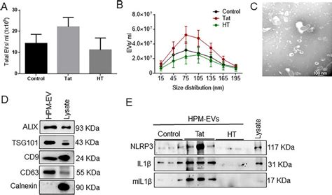 Characterization Of Microglia Derived Exosomes From Human Primary