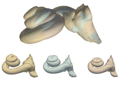 Three Virtual Patients From The Statistical Shape Model Are Overlapped Download Scientific