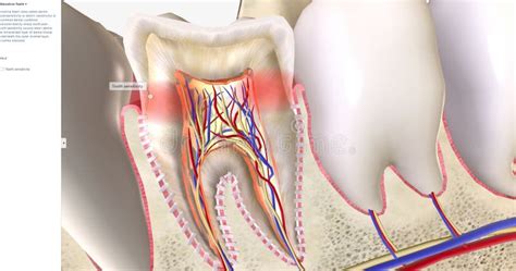 Sensitive Teeth Is A Common Dental Condition Characterized By Sharp