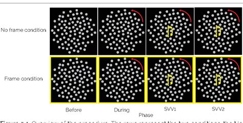 Figure 51 From Chapter 5 Framing Visual Roll Motion Affects Postural Sway The Subjective