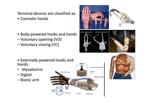 Prosthesis Pdf