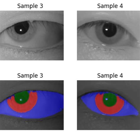 Pupil Eye And Iris Segmentation Kaggle
