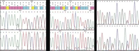 Examples Of Types Of Consensus Sequences Obtained A Clear Consensus