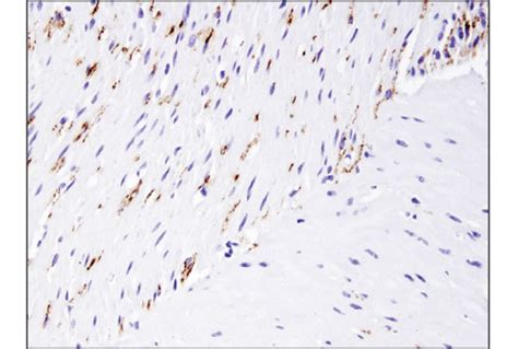 Vip D8j1v Rabbit Mab Ihc Formulated Cell Signaling Technology
