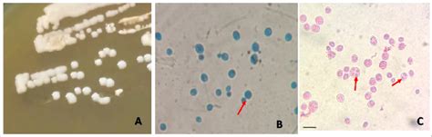 A Macro And Micromorphology Of Saccharomyces Cerevisiae Pure Culture