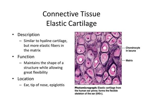 Reticular Connective Tissue Location And Function At Cristy Fields Blog