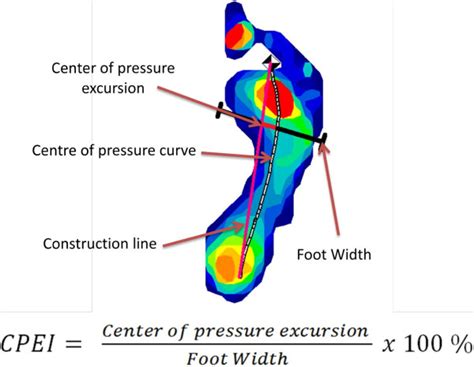 Calculation Of The Center Of Pressure Excursion Index Cpei In The