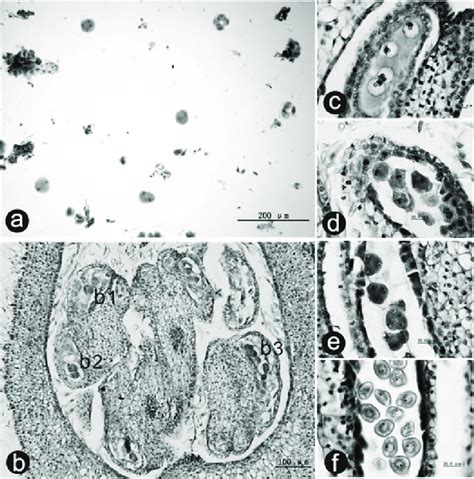 Microsporogenesis In Anthers A Asynchronism Meiosis Development In Download Scientific