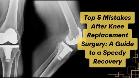 Top 5 Mistakes After Knee Replacement Surgery Updated Guide