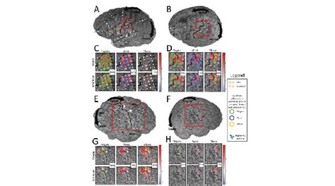 Decoding Native Cortical Representations For Flexion And Extension At Upper Limb Joints Using