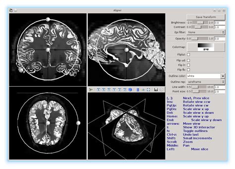 Alignments — Pycortex 1211 Documentation