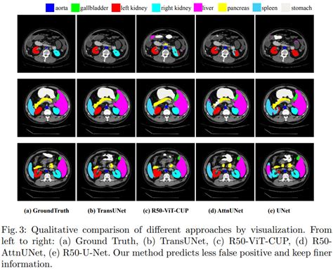 Transunet Transformers Make Strong Encoders For Medical Image Segmentation