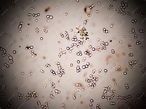 Premium Photo Budding Yeast Cells In Patient Urine Urinary Tract Infections Pyelonephritis Or