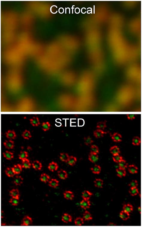 Nuclear Pore Complexes In An Intact Cell Nucleus Imaged By Dual Color