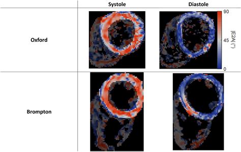 Intercentre Reproducibility Of Second Eigenvector Orientation In Cardiac Diffusion Tensor
