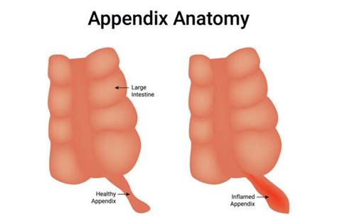 Appendix Anatomy Science Design Vector Graphic By Hamjaiu · Creative Fabrica