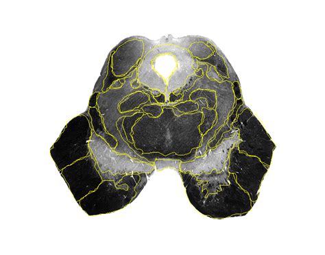 Midbrain Inferior Colliculus Quiz