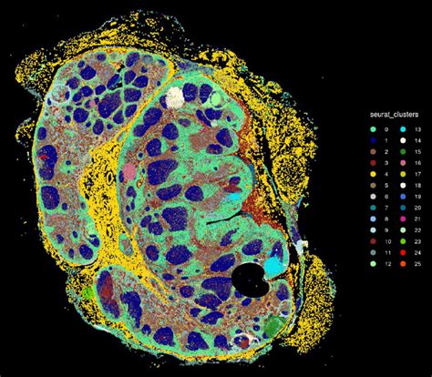 Spatial Multi Omics For Cancer Systems Biology