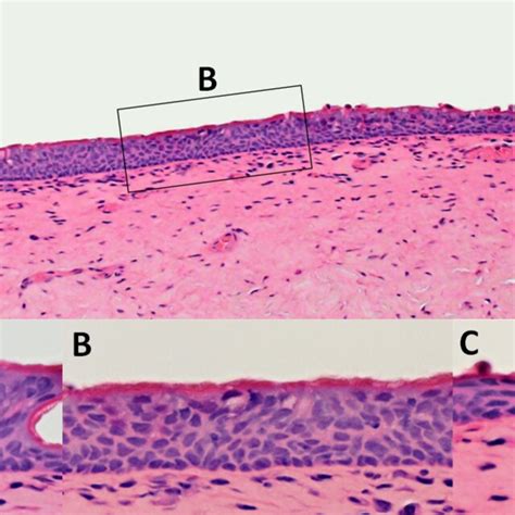 Histology Of The Cervical Squamo‐columnar Junction Hematoxylin‐eosin