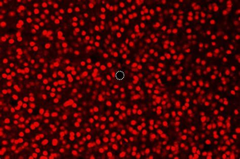 Microneedle Electrode Based Device Overcomes Long Standing Challenges In Neural Recording