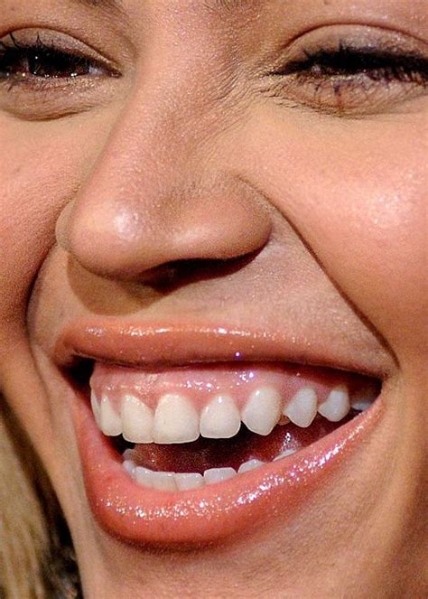 Beyoncé Celebrity Teeth Beyonce Skin Beyonce Nose
