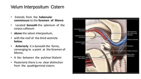 Anatomy Of Subarachnoid Cisterns Of Brain Pptx Anatomy Of Subarachnoid Cisterns Of Brain Pptx