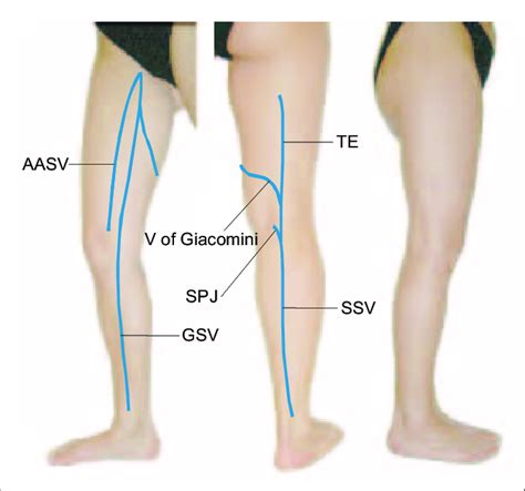 Superficial Veins Of The Leg