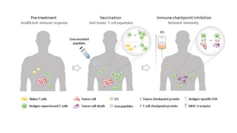Faheez Mohamed On Linkedin A Step Closer To A Novel Treatment Option For Recurrent Pmp