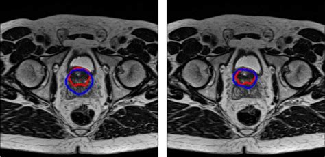 The Effect Of Selecting Three Key Slices On The Segmentation Download Scientific Diagram