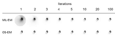 Different Iteration Numbers For The Ml Em And Os Em Reconstruction