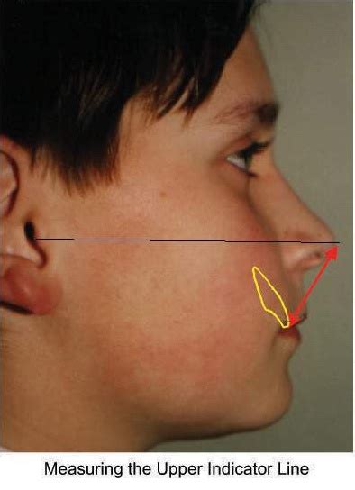 Indicator Line Biobloc International
