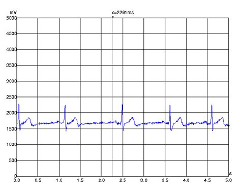 Electrocardiogram ECG Circuit For Use With Oscilloscopes PicoTech Library
