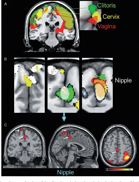 Figure 3 From Womens Clitoris Vagina And Cervix Mapped On The