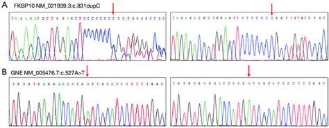 Confirmatory Analysis Of Our Whole Exome Sequencing Data By Sanger