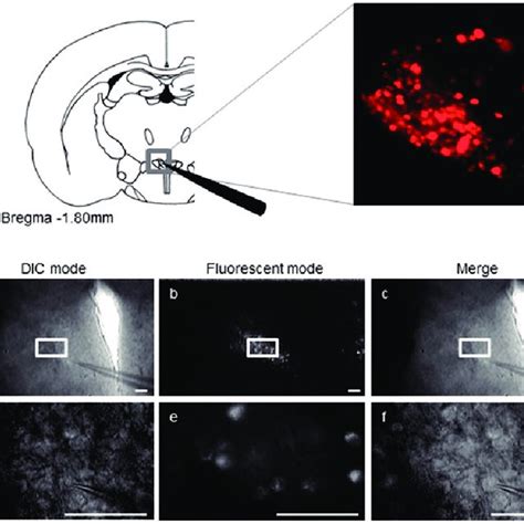 In Vitro Whole Cell Patch Clamp Recording Of Neurons In The Download Scientific Diagram