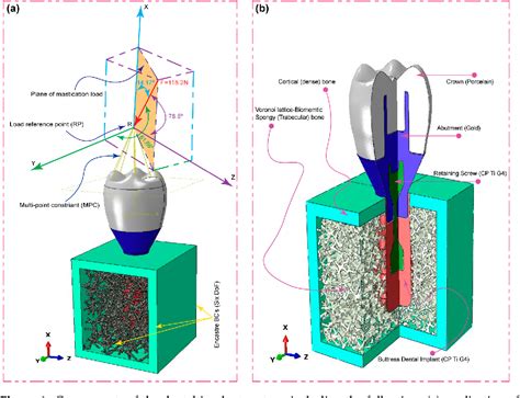 Figure 1 From Advancing 3d Dental Implant Finite Element Analysis Incorporating Biomimetic