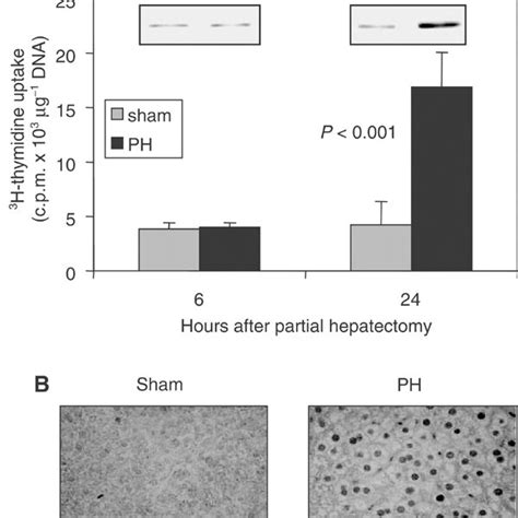 K Protein Expression After Partial Hepatectomy In Mice A Total Rna
