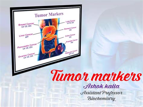Tumor Markers Ppsx
