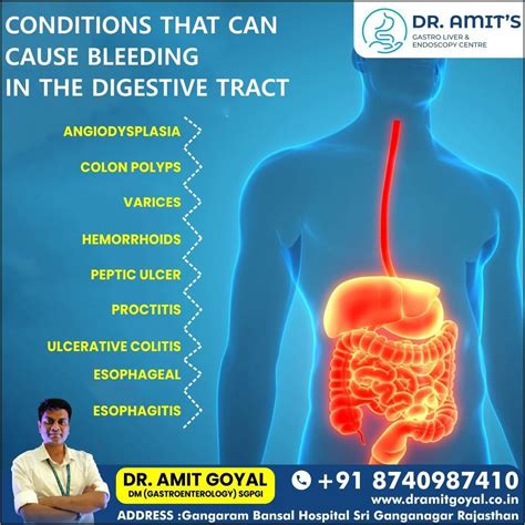 Dr Amit Goyal On Linkedin Liver Liversafty Ercp Procedure Ercp Painabdomen Nausea