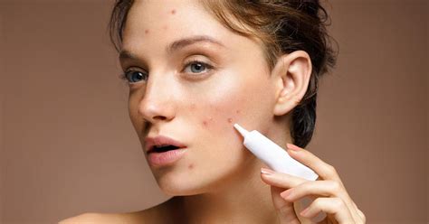 The Correct Way To Apply And Use Acne Spot Treatment